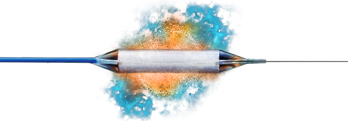 Optilume Urethral Stricture Treatment | Georgia Urology